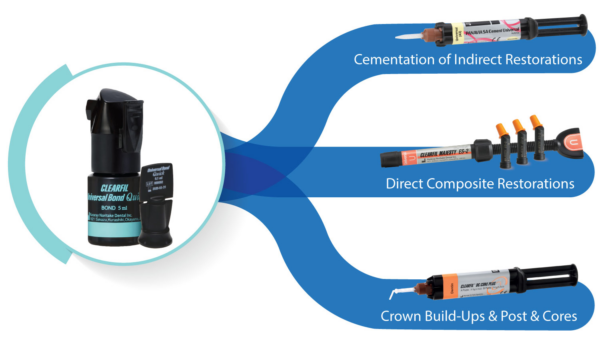 The CLEARFIL™ PANAVIA™ Universal Restorative Materials - Kuraray Dental