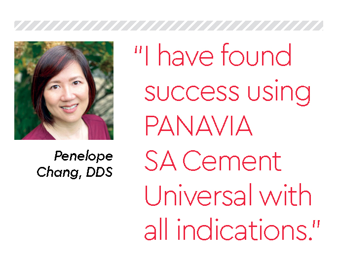 Cementing Confidence in Restorative Procedures - Kuraray Dental