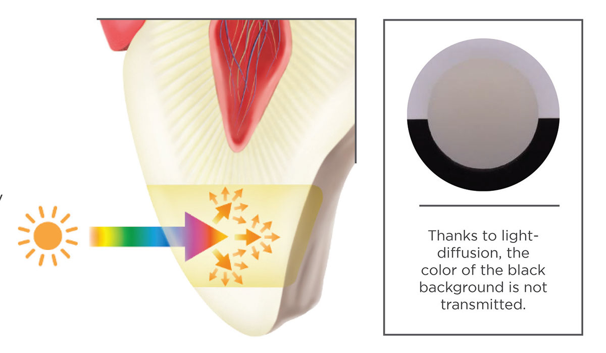 Introducing CLEARFIL MAJESTY ES Flow Universal - Kuraray Dental